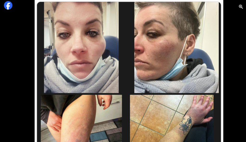 Laura Ciriaco rapinata e pestata: «Voi che siete passati e non mi avete ...